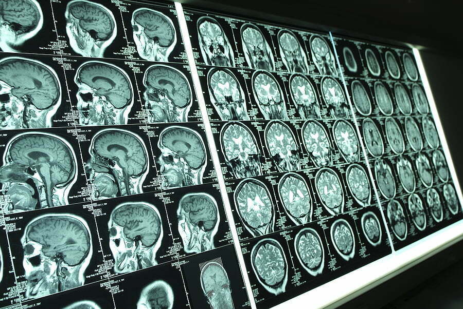 NHS Tele-Radiology Services Provider To Deploy PACS