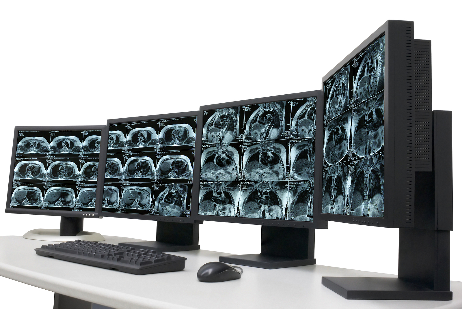 Medical Imaging: Cost Efficiency And Enhanced Accessibility